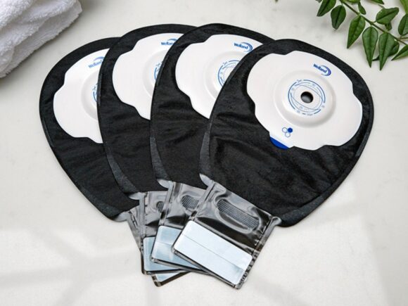 What is a retracted stoma? | CliniMed